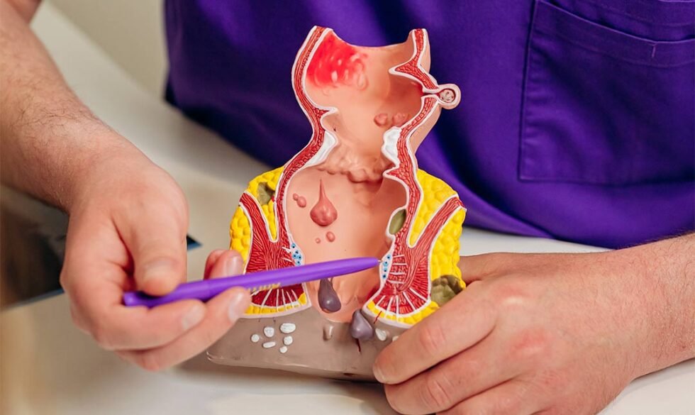 ¿Qué es un Proctólogo y Cuándo Deberías Consultar a Uno? - Proctoclínica